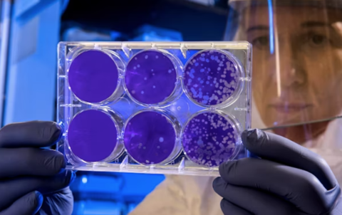 Helicobacter Pylori: Symptoms, Diagnosis, Treatment & Prevention