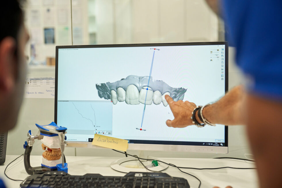 How Modern Dental Technology Influences Veneer Cost and Quality - Women ...